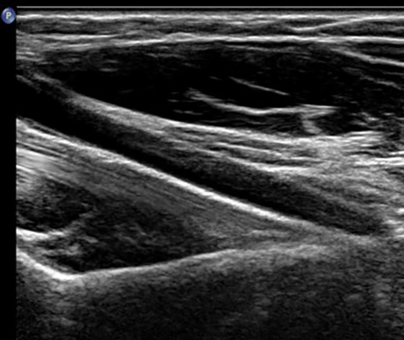 John Persinger | JP-MSK